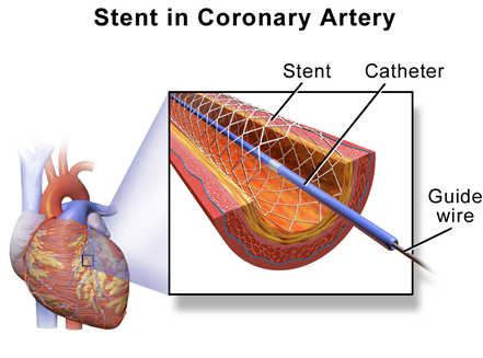 Assessments - Dr Vivek Kodoth - Stent - Private Practise